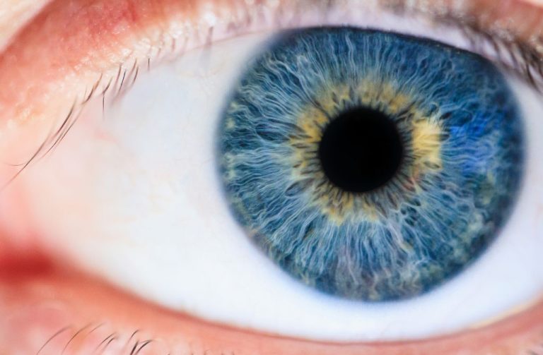 Iris Mata Bikin Mata Jadi Cantik, Ini 8 Penyakit Pada Iris